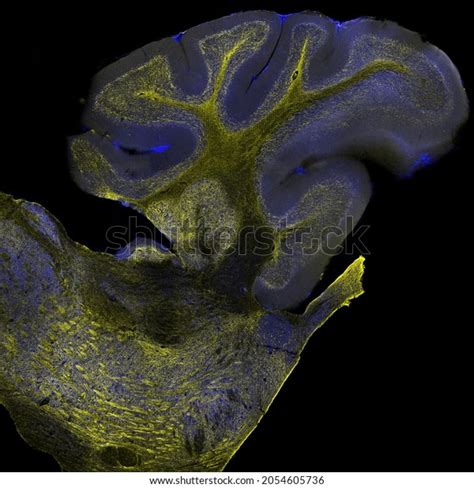 Sagittal Section Mouse Cerebellum Part Hindbrain Foto Stock 2054605736 Shutterstock