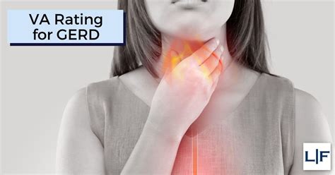 Gerd Va Rating Explained Lunn And Forro