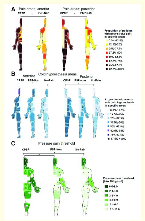 Pain Area And Cold Hypoesthesia Distribution According To Pain Groups