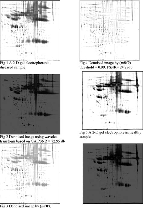figure 1 from de noising 2 d gel images using wavelet transform based