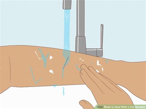 5 Ways To Deal With A Cat Scratch WikiHow