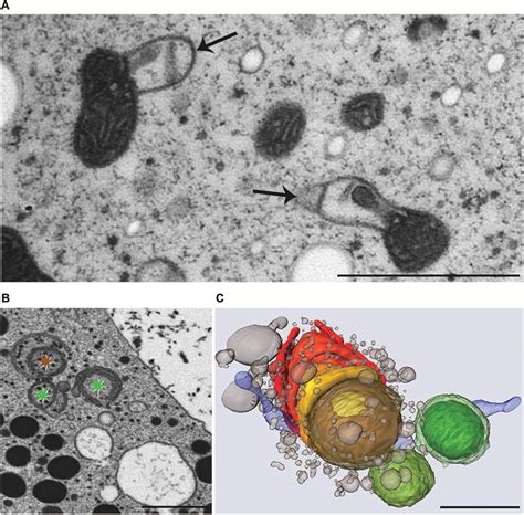 Transmission Electron Microscopy Micrographs Of Mitochondria A