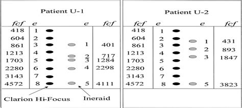 Speech Understanding By Cochlear Implant Patients With Diffe Ear And Hearing