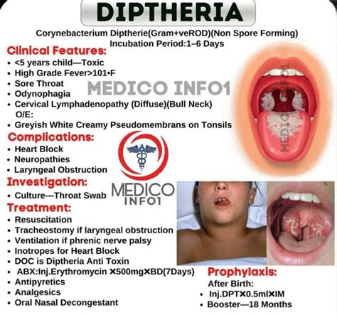 Diphtheria Symptoms Diagnosis And Treatment Dr S0 Mikaye Posted