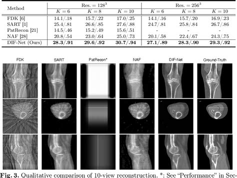 Learning Deep Intensity Field For Extremely Sparse View Cbct