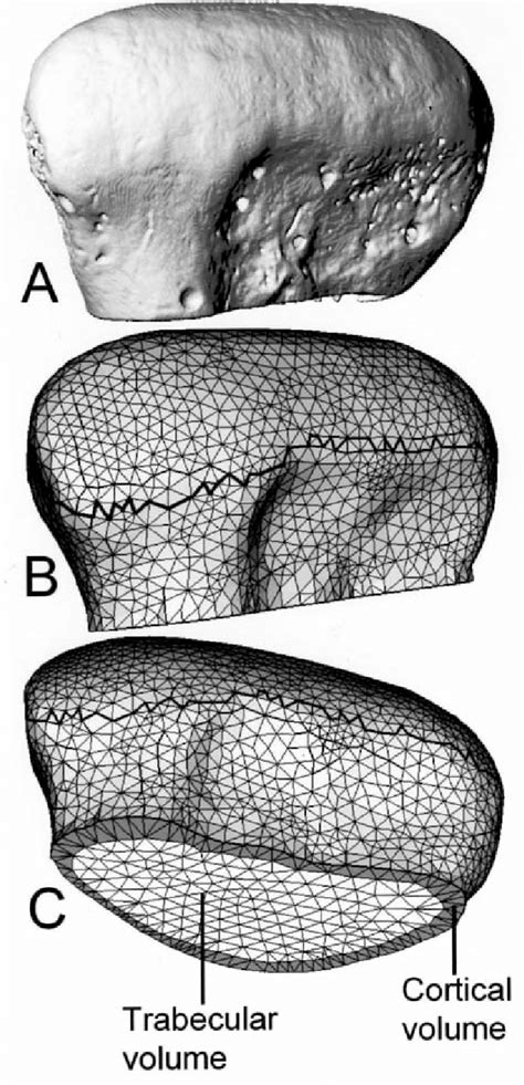 The Original Ct Scan A And The Finite Element Model Bc The Border