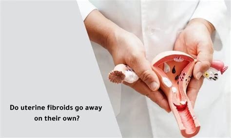 Understanding Endometriosis And Uterine Fibroids London Fibroid Clinic