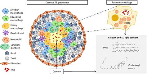 The Lipid Environment Of Mtb In Caseous Tb Granulomas Within Foamy Download Scientific Diagram