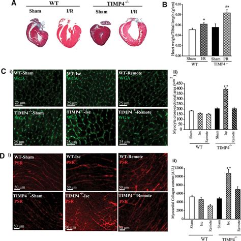 Myocardial Recovery From Ischemiareperfusion Is Compromised In The Absence Of Tissue Inhibitor