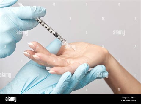 The Doctor Makes Injections Of Botulinum Toxin On The Palms Of A Woman