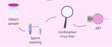 Clotting Time Test Principleprocedure By Capillary Method