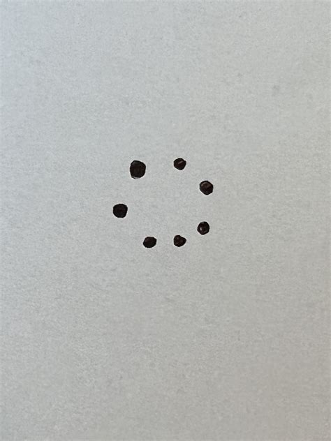 사랑가득 상담실 사랑가득안과 톱니바퀴 모양의 번쩍임 잔상이 보여요