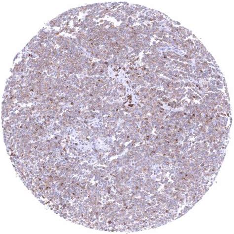 Cancer Tissue Gallery Igd Ms Validated Antibodies