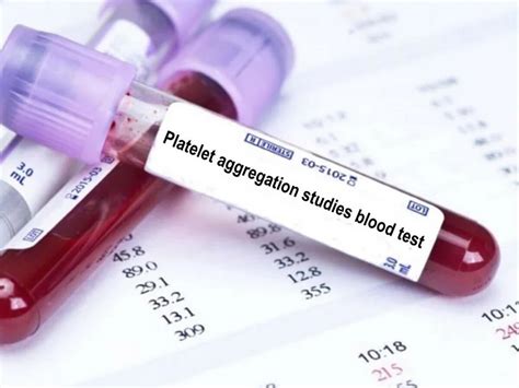 Platelet Aggregation Studies Platelet Aggregation Studies