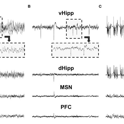 Seizure Thresholds Across The Racine Scale Download Scientific Diagram