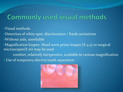 Contemporary Methods Of Caries Detection Pptx
