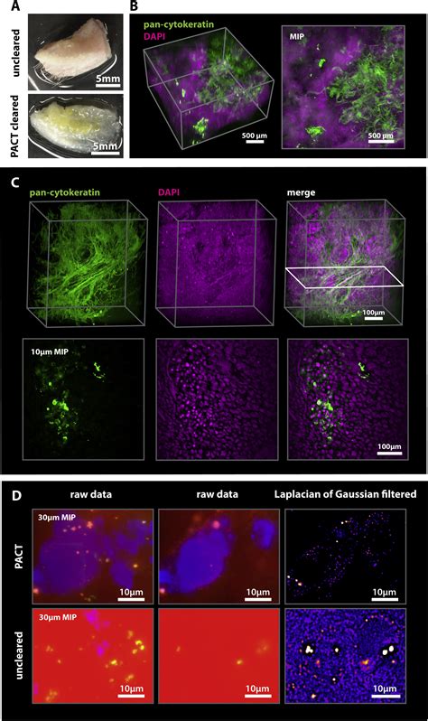 Single Cell Phenotyping Within Transparent Intact Tissue Through Whole Body Clearing Cell