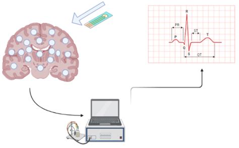 a schematic diagram of the eeg measurement and data acquisition system