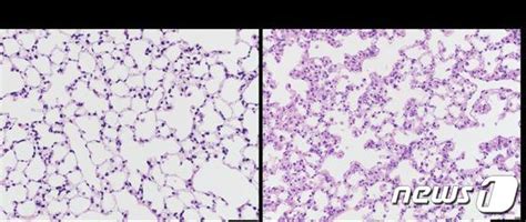 한·미 연구진 폐 재생능력 향상 폐줄기세포 분화 촉진 메커니즘 밝혀 뉴스1