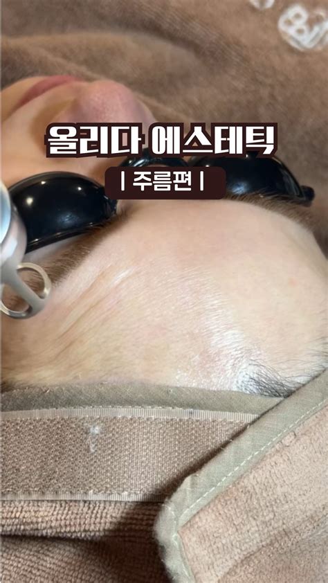 수원피부관리ㅣ항노화피부관리 전문ㅣ 올리다에스테틱 수원본점 🟤항노화피부관리 전문ㅣ올리다에스테틱🟤 나이들어보이게 하는것들🫣 ☑️