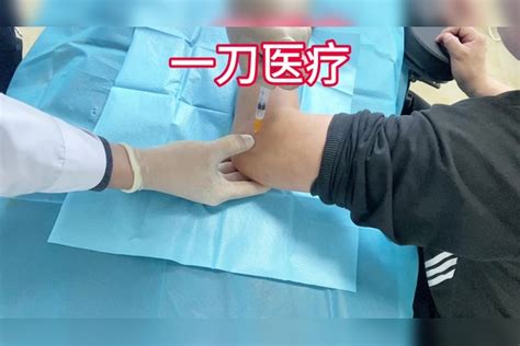 网球肘怎么治疗？ 网球肘治疗