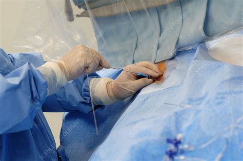 Inserting The Guide Wire Stock Image C Science Photo Library