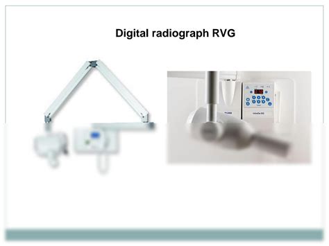 Solution Radiograph Aids In Diagnosis Of Periodontal Desease By Mb