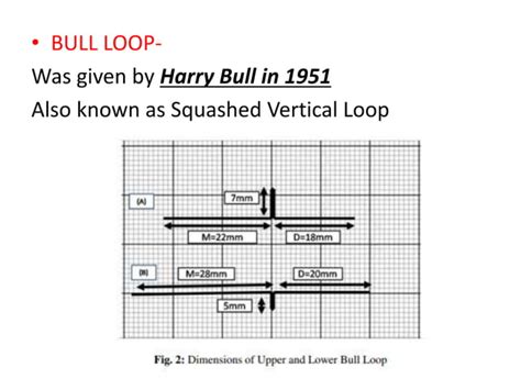 Loops In Orthodontics T Loop Bull Loop Vertical Loop Mushroom Loop Stop