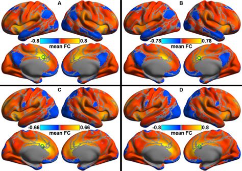 Intrinsic Functional Connectivity Ifc Of The Dorsal Anterior