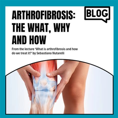Arthrofibrosis The Why What And How