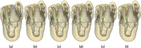 The Finite Element Model Of Each Operating Mode Before And After