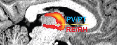 The MPFC HC Memory System Allen Neurocircuitry Cognition Lab
