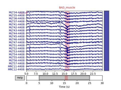 Annotate Muscle Artifacts — Mne 0 22 1 Documentation