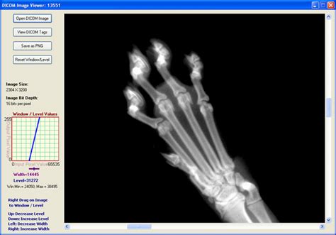 TECHNOPHILIA DICOM Image Viewer