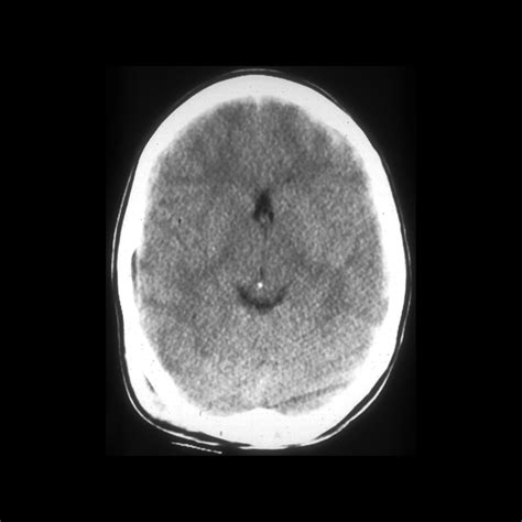 June 10 2023 Pediatric Imaging