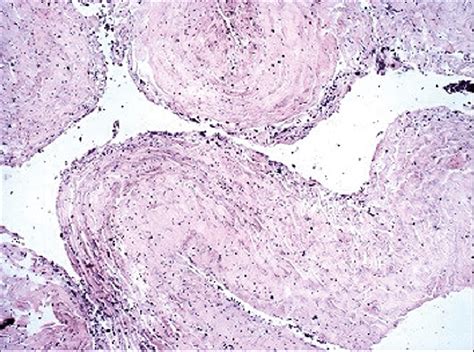 Cross Section Through The Reconstructed Ureter The Stellate Lumen Is Download Scientific