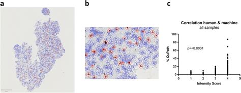 Illustration Of The Automated Digital Pathology Cell Identification And Download Scientific