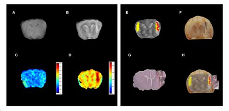 Standard Vs Mrr Analyses And Histopathological Validation Example