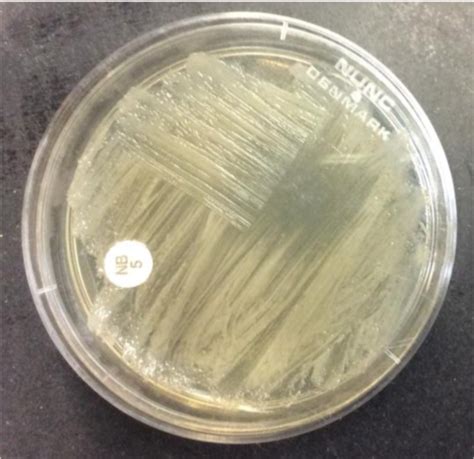 Staphylococcus Saprophyticus · Inaturalist