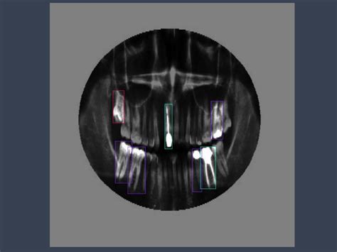 Data Annotation Bounding Boxes For Your Ai Module Upwork