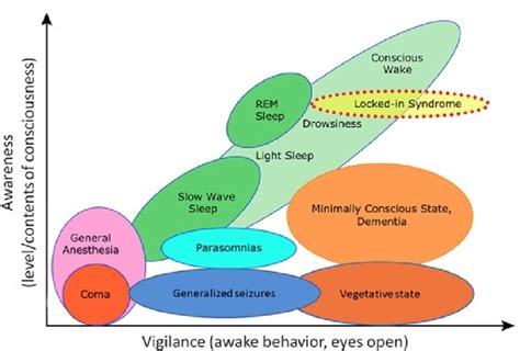 2 Clinical States Of Consciousness Defined By The Vigilance And Download Scientific Diagram
