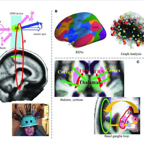 Schematic Images From Psychiatric Research Implementing The Squid Meg Download Scientific