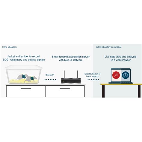 Lasa Ecg Delineation Analyzer Module