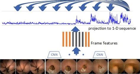 Proposed Temporal Segmentation Pipeline For Ce Videos Download