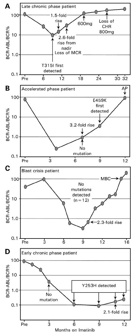Serial Measurement Of Bcr Abl Transcript Levels In Patients With A Rise