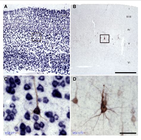 Corticofugal Neurons In Layer 5 V Express Only Vglut1 Brightfield