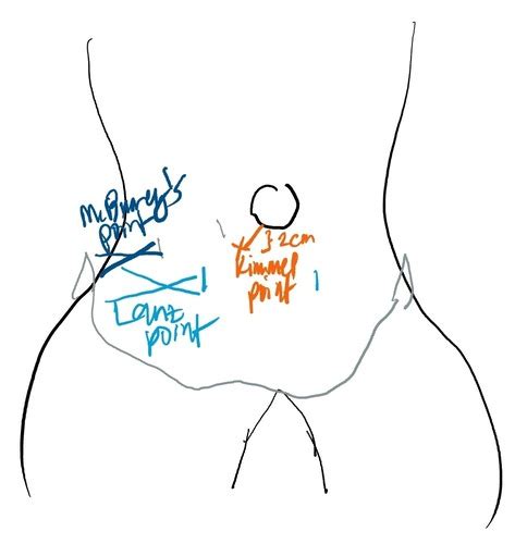 Appendix Flashcards Quizlet