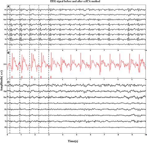Frontiers Clustering Constrained Ica For Ballistocardiogram Artifacts Removal In Simultaneous