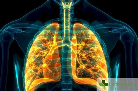 ᐉ ХОББ какво представлява — Lechenie Bg