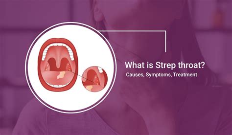 Strep Throat: Causes, Symptoms, Treatment | Ace Neuro & ENT Clinic